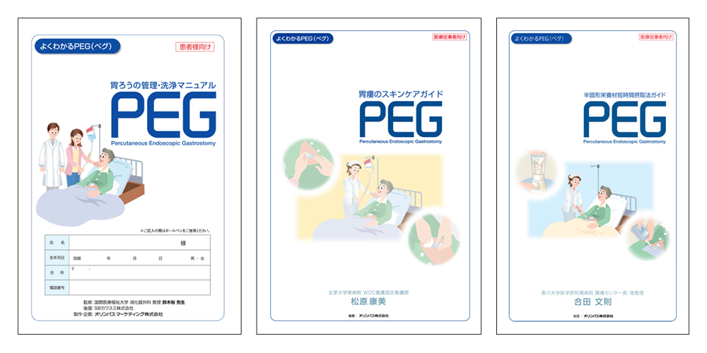 PEG関連情報 | 処置具 | 消化器内科 | オリンパス医療ウェブサイト